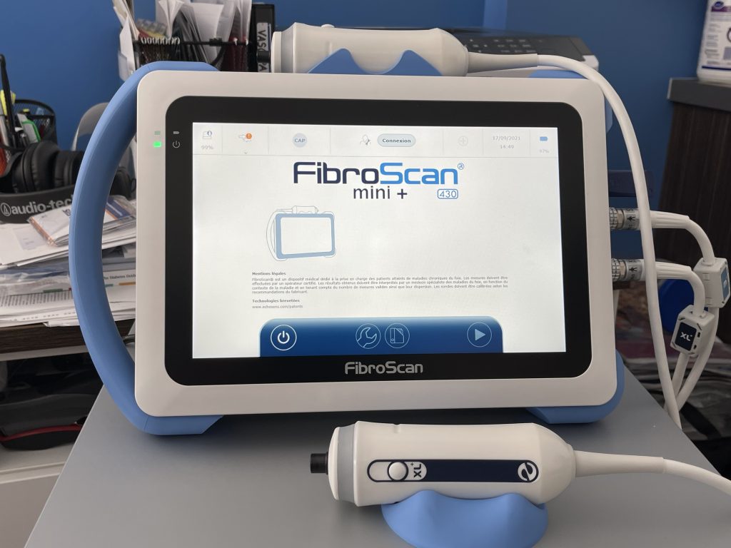 Fibroscan – Centre de Médecine Métabolique de Lanaudière